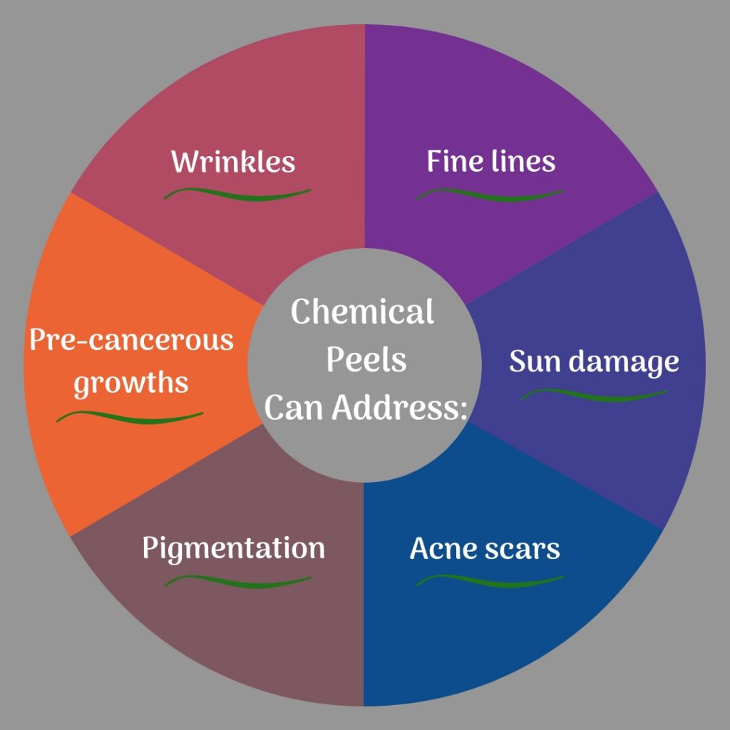 What Is a Chemical Peel? - Temecula, CA | Dr. Kelly O'Neil